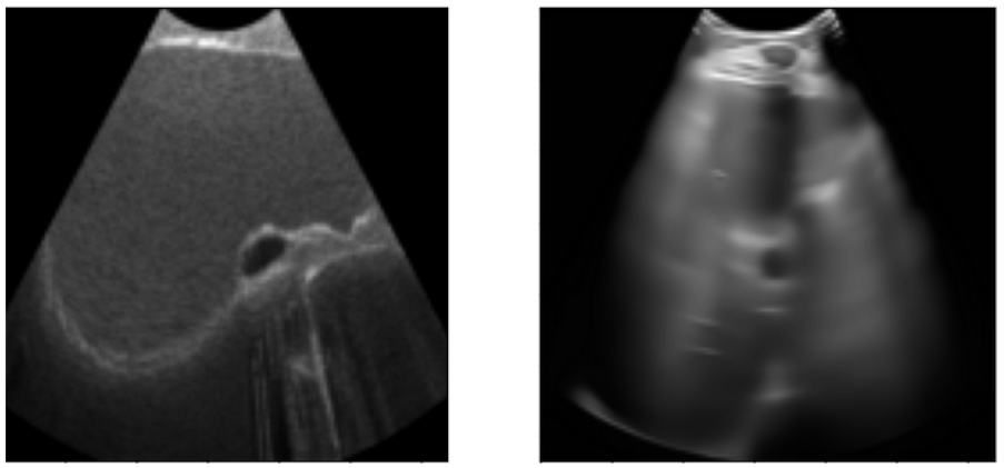 Diffusion Models for Simulated-to-Real US Image Conversion | Demir Arikan